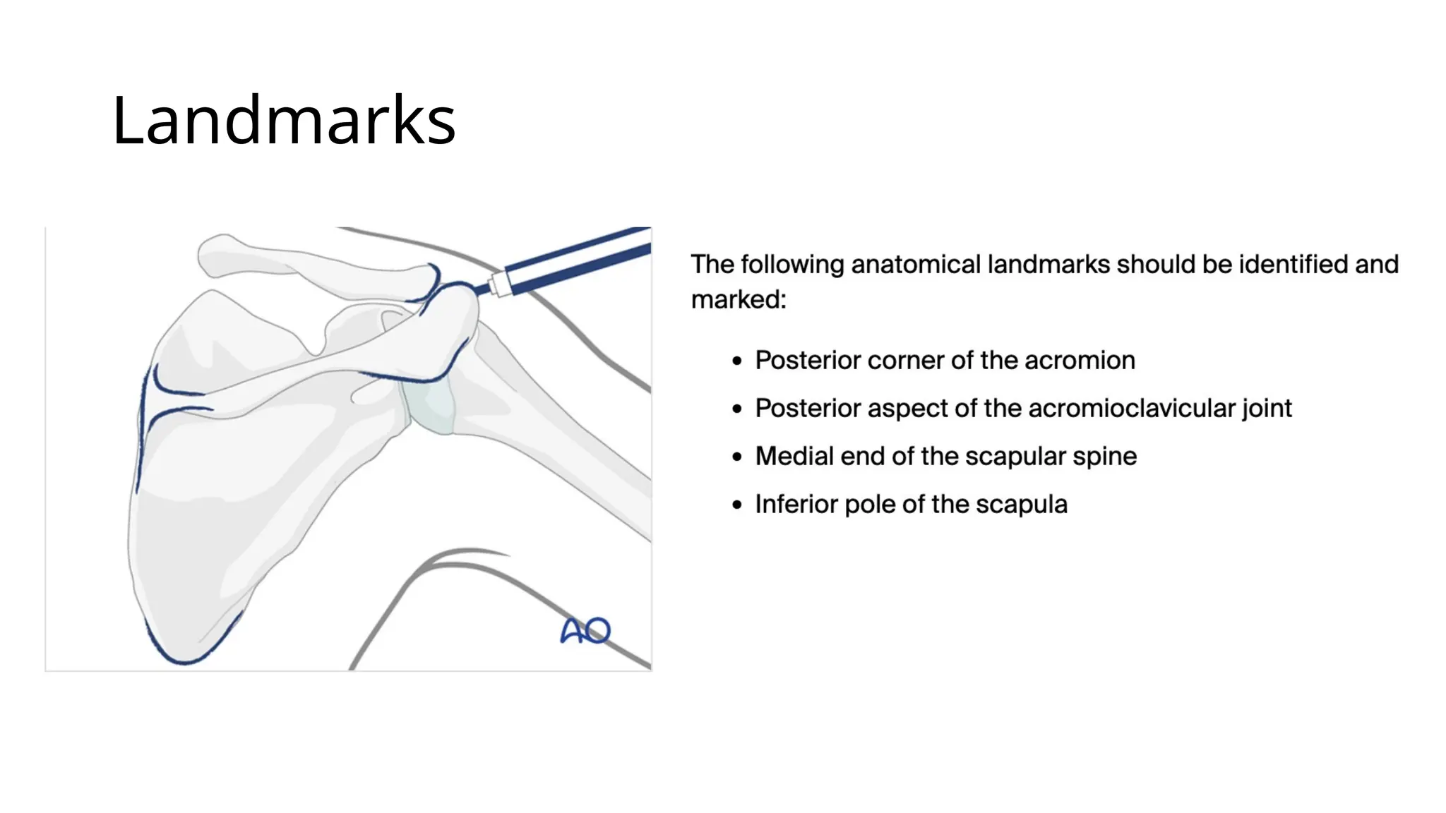 Approach Scapula in Orthopedic Field.pptx