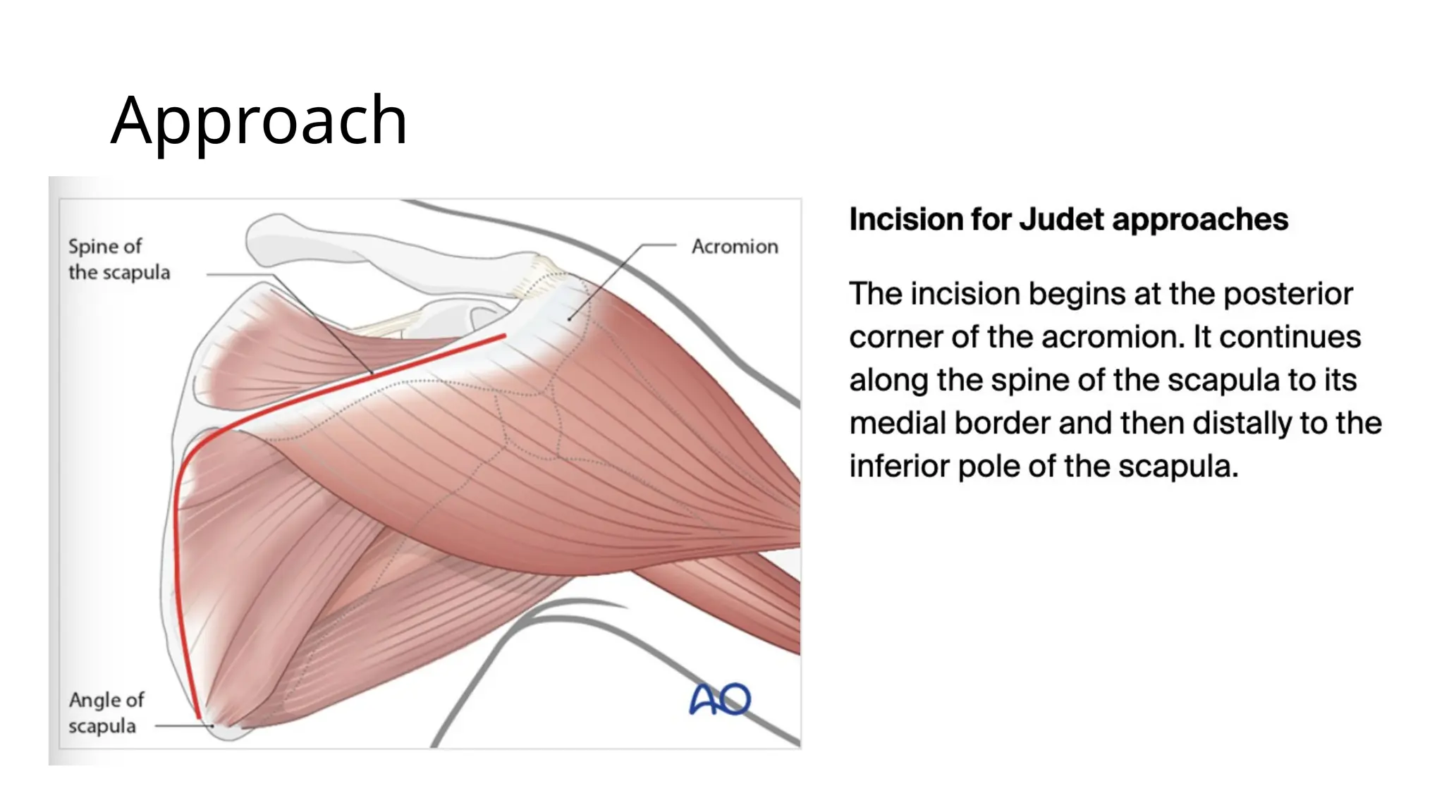 Approach Scapula in Orthopedic Field.pptx
