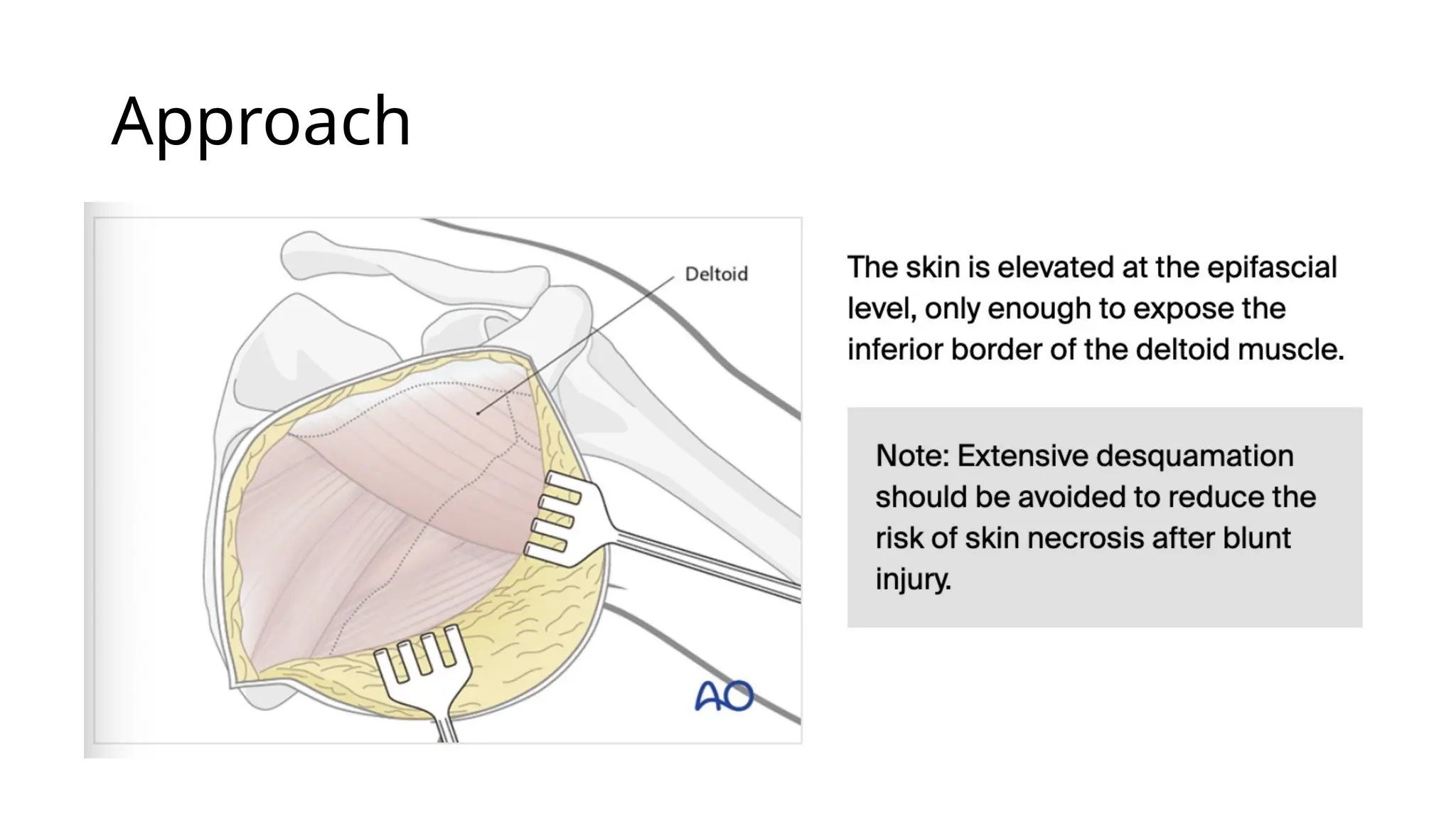 Approach Scapula in Orthopedic Field.pptx