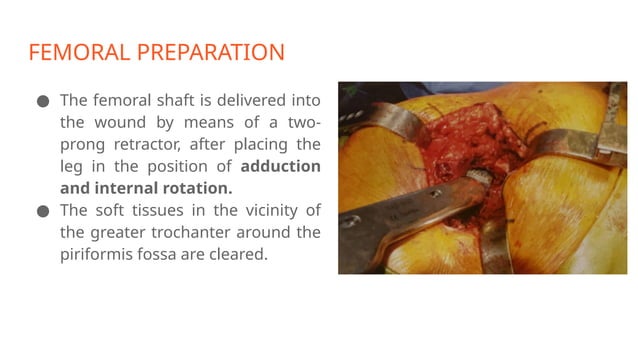 APPROACH THA.pptx....................... | PPT