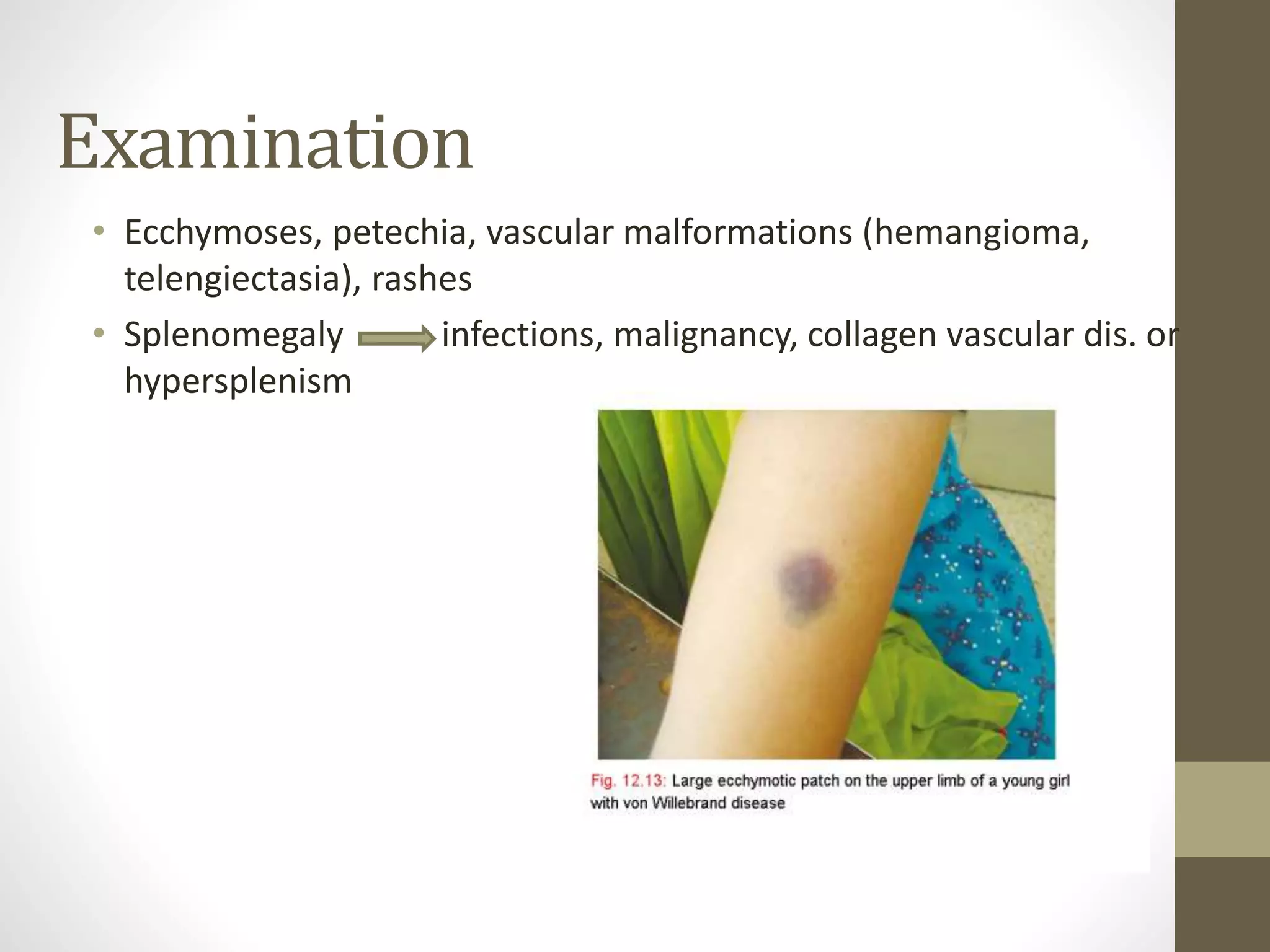 Approach to a bleeding child | PPTX