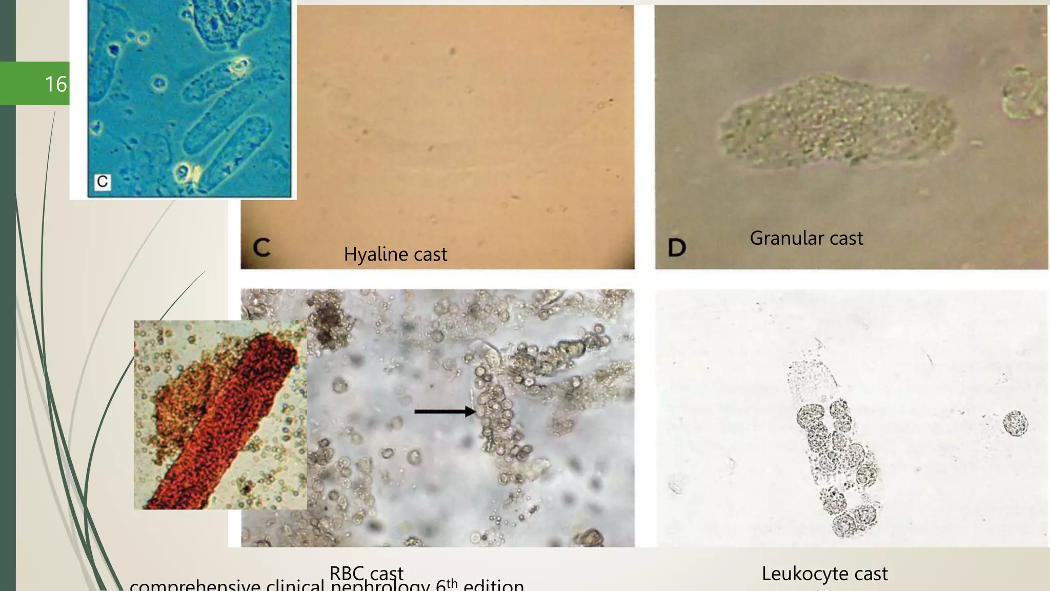 Approach to abnormal RENAL FUNCTION TEST.pptx