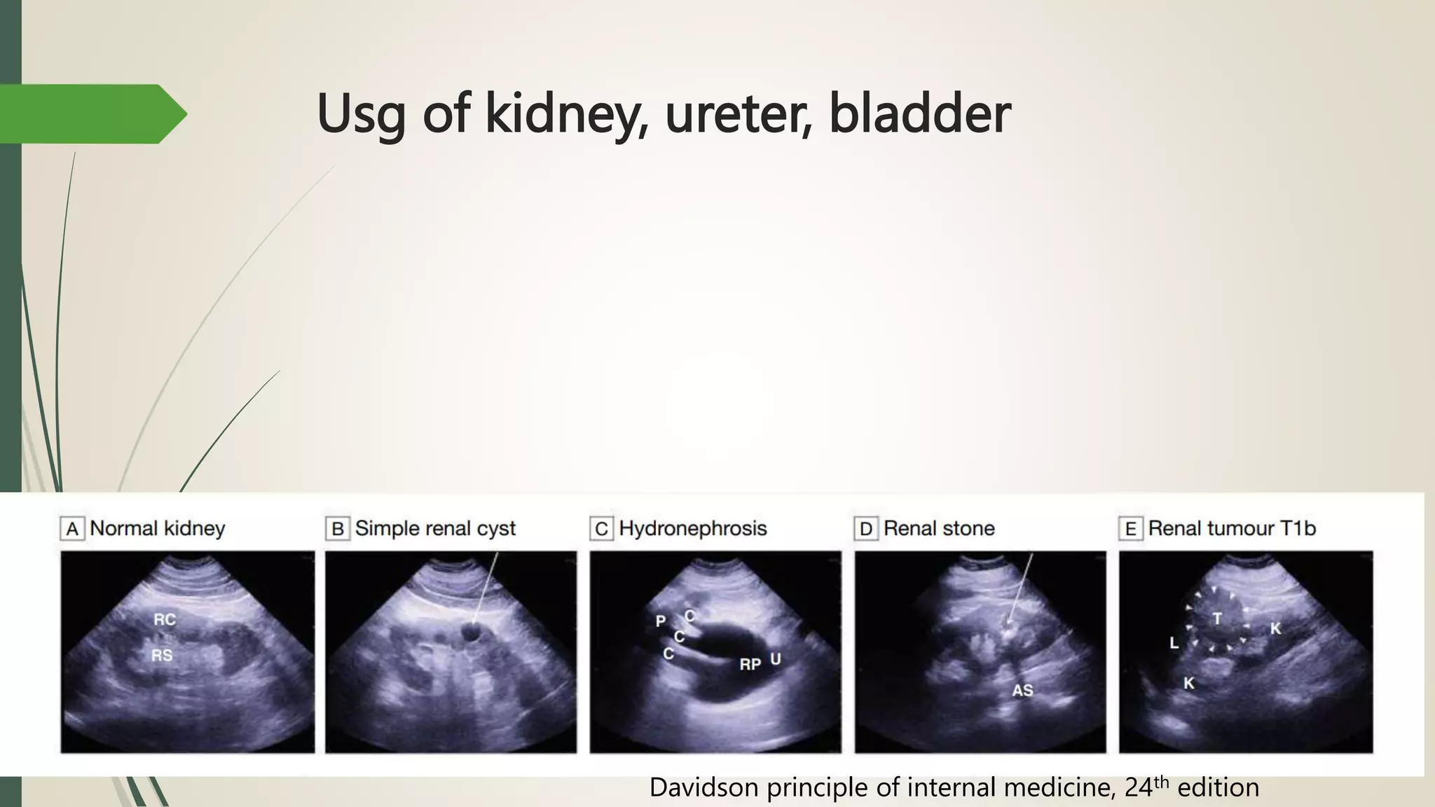 Approach to abnormal RENAL FUNCTION TEST.pptx