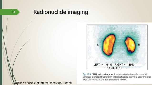 Approach to abnormal RENAL FUNCTION TEST.pptx