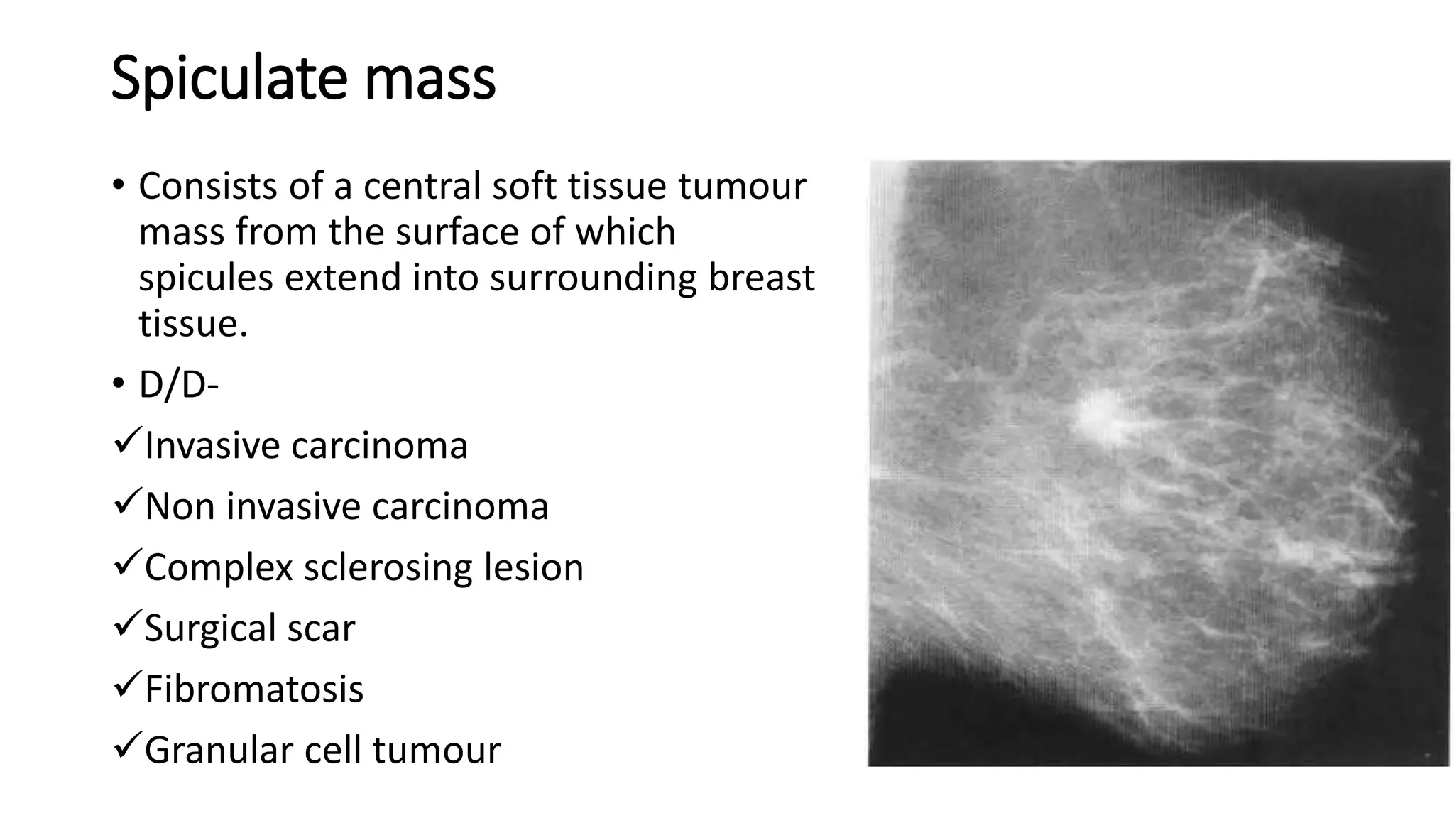 APPROACH TO A BREAST LESION- MAMMOGRAPHY AND ULTRASONOGRAPHY.pptx