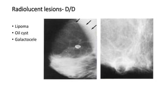 APPROACH TO A BREAST LESION- MAMMOGRAPHY AND ULTRASONOGRAPHY.pptx