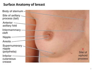 Approach to a breast lump (hari sedai; MMC, IOM) | PPTX