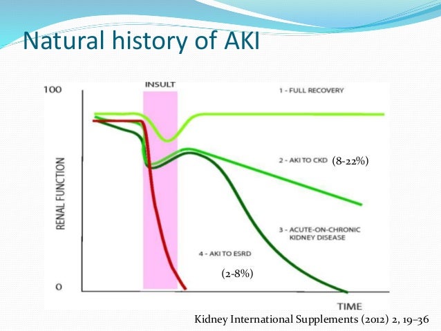 Approach to a case of aki