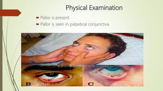 Approach to a case of anemia | PPTX