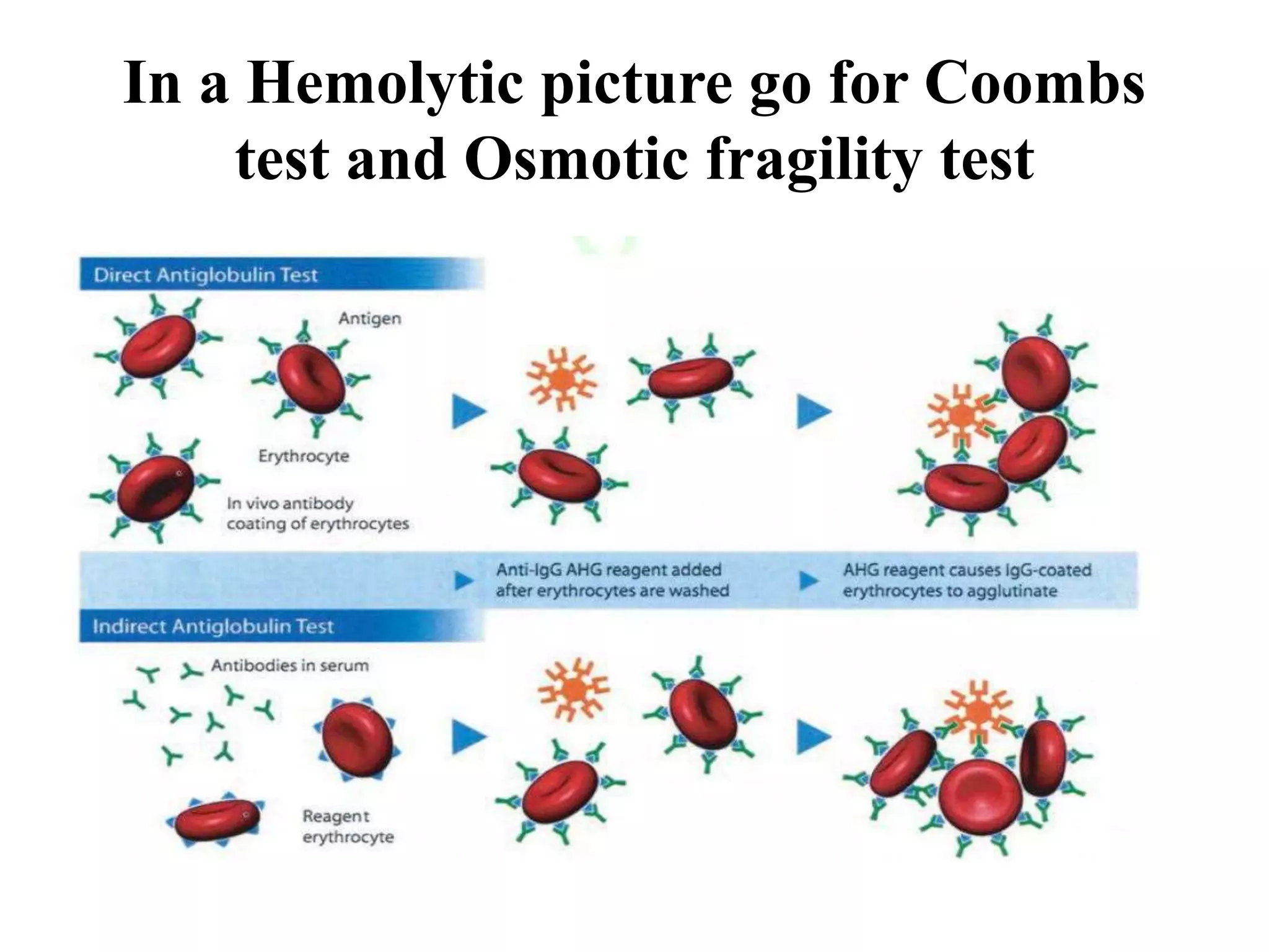 approach to anemia | PPTX