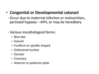 APPROACH TO A CASE OF CATARACT.pptx