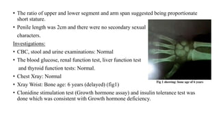 Approach to a case of Hypopituitarism.pptx