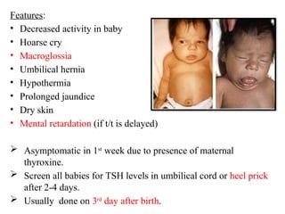 Approach to a case of Hypothyroidism.pptx | Free Download