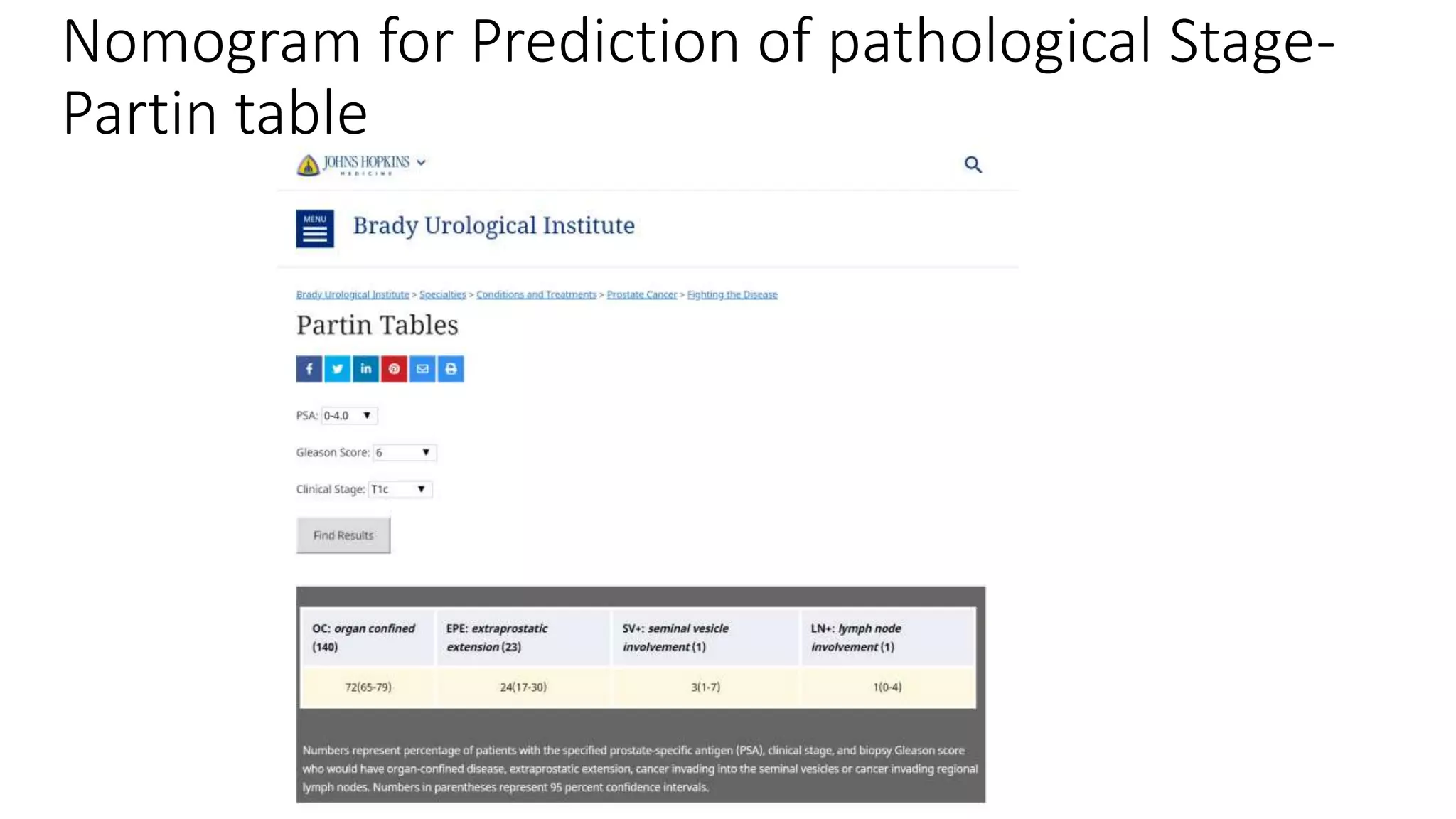 Approach to a case of localized prostate cancer | PPTX