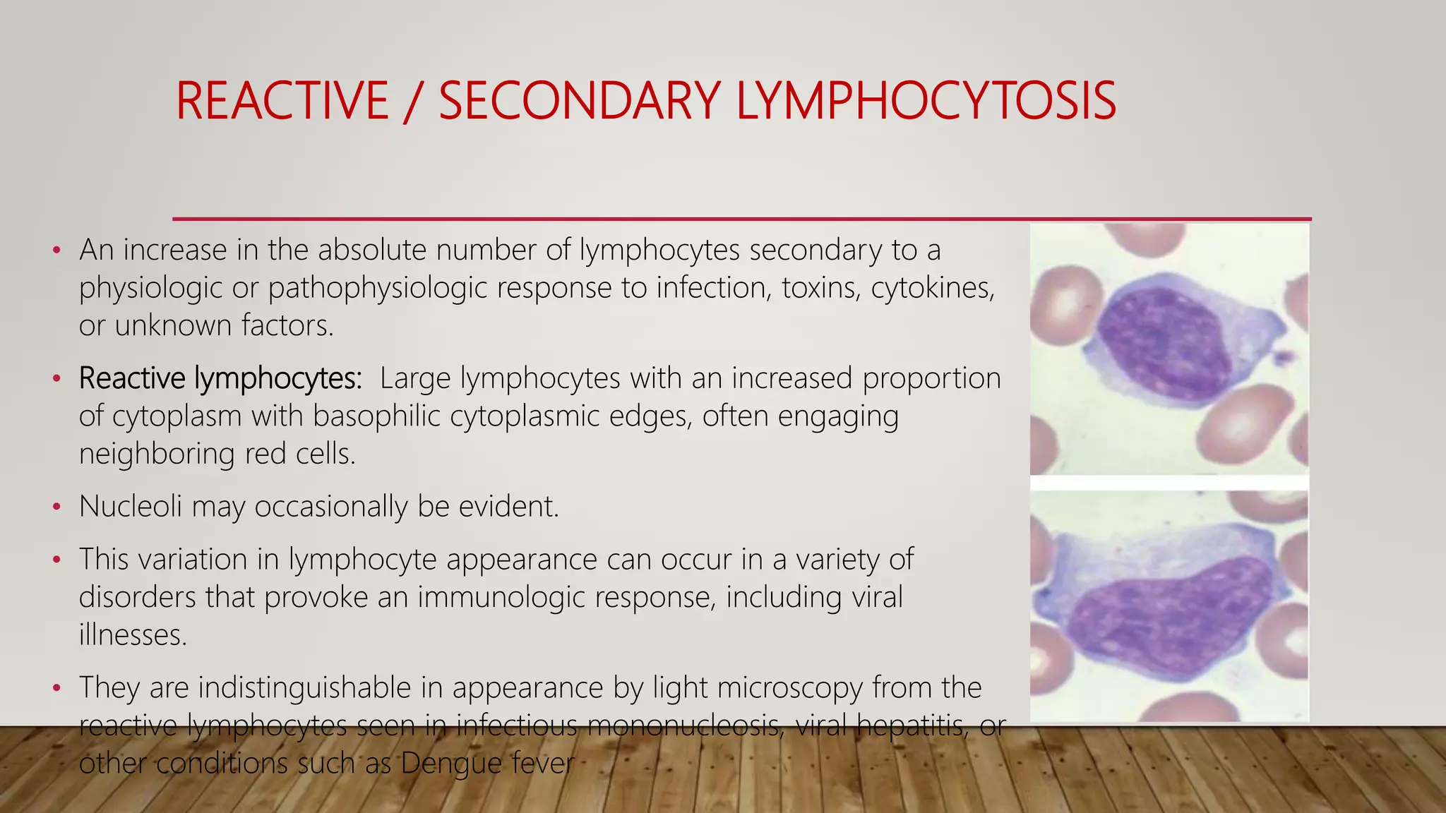 Approach to a case of lymphocytosis | PPTX