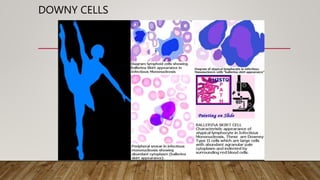 Approach to a case of lymphocytosis | PPTX