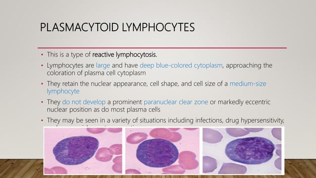 Approach to a case of lymphocytosis | PPTX | Blood Disorders | Diseases ...