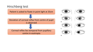 Approach to accommodative esotropia | PPTX