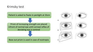 Approach to accommodative esotropia | PPTX