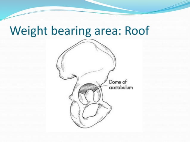 Approach to acetabulum fracture zoom 2020 | PPT