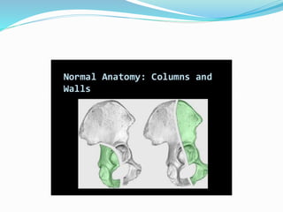 Approach to acetabulum fracture zoom 2020 | PPTX