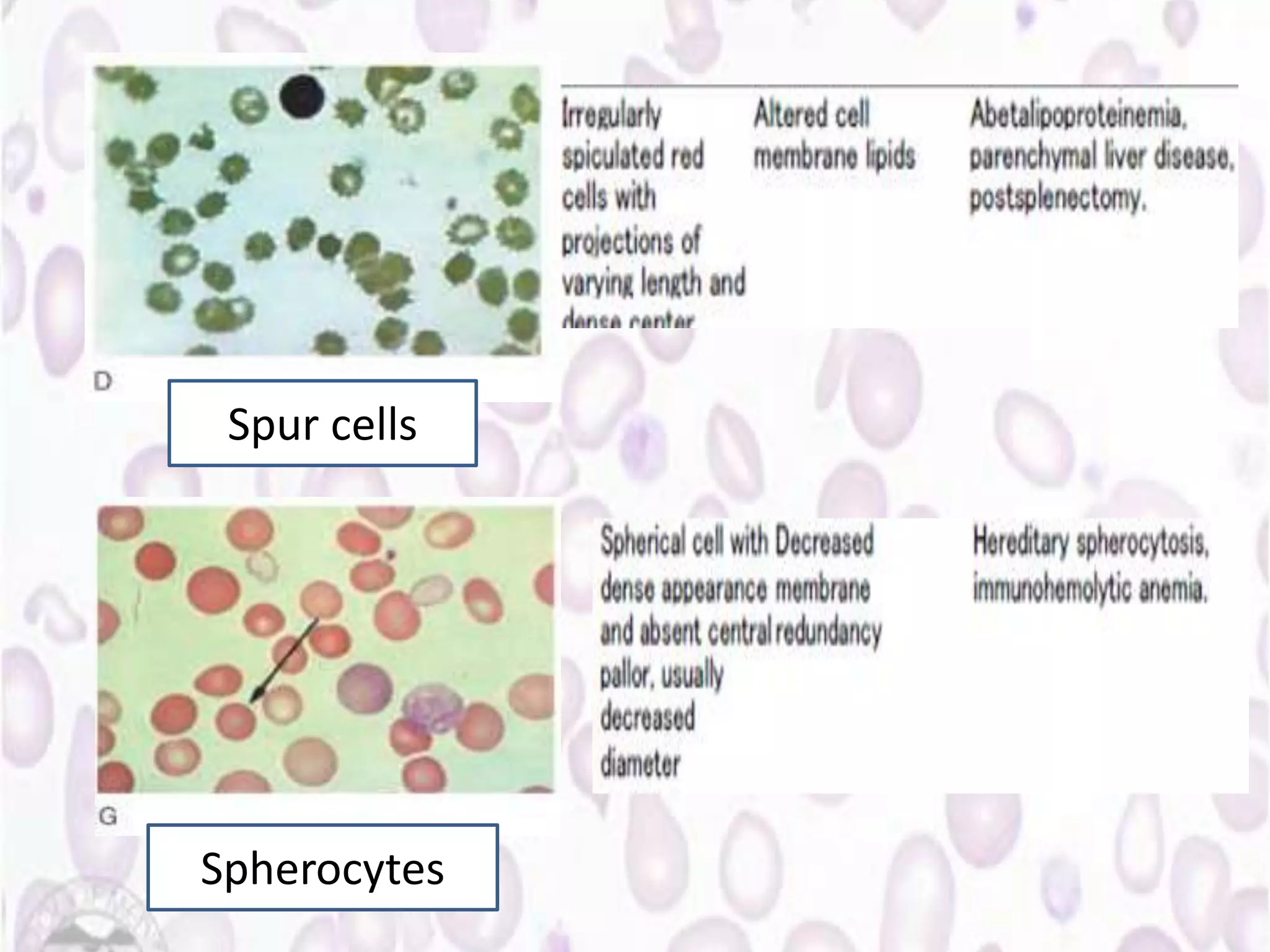 a child with anaemia - an approach | PPTX