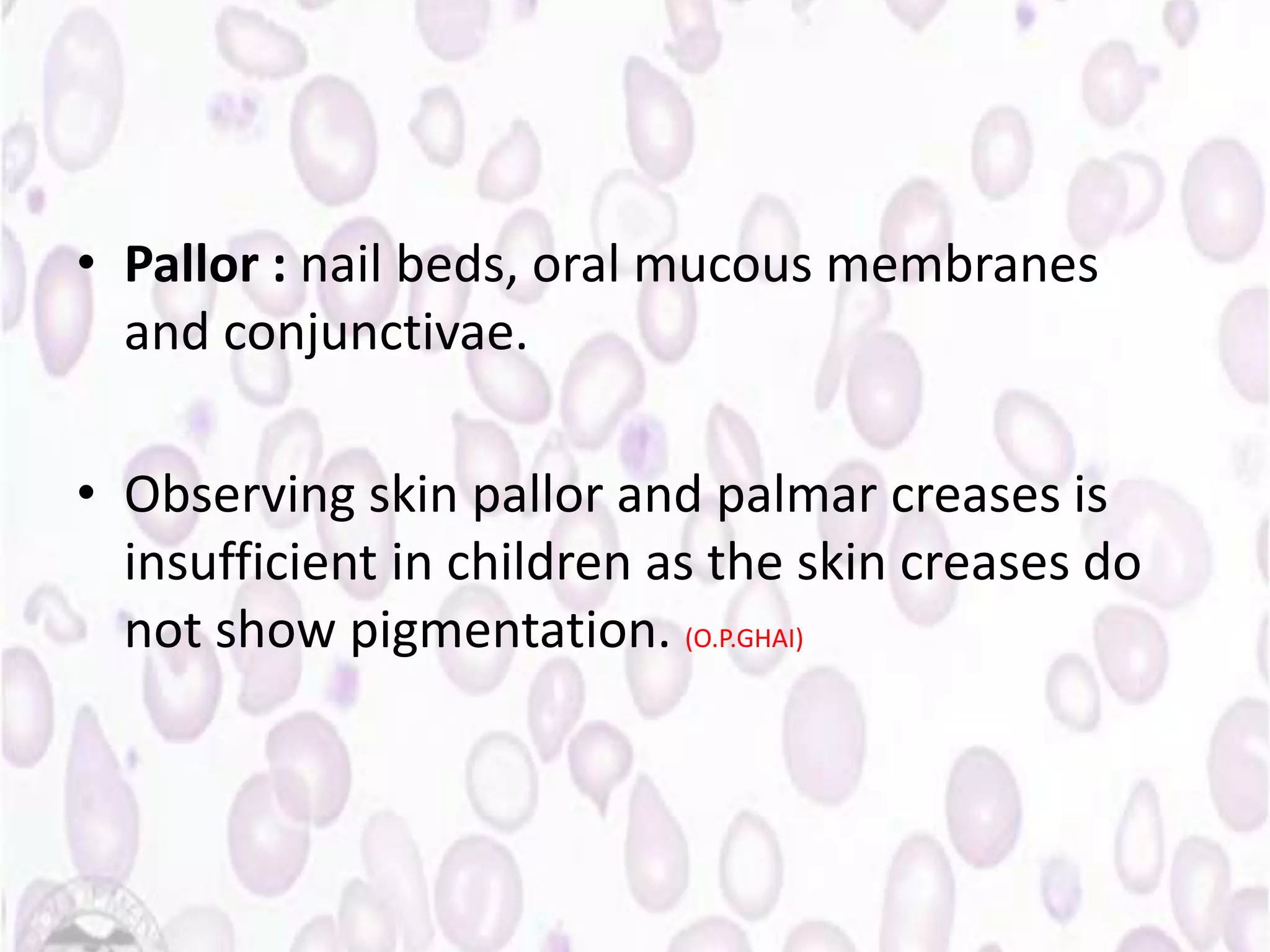 a child with anaemia - an approach | PPTX