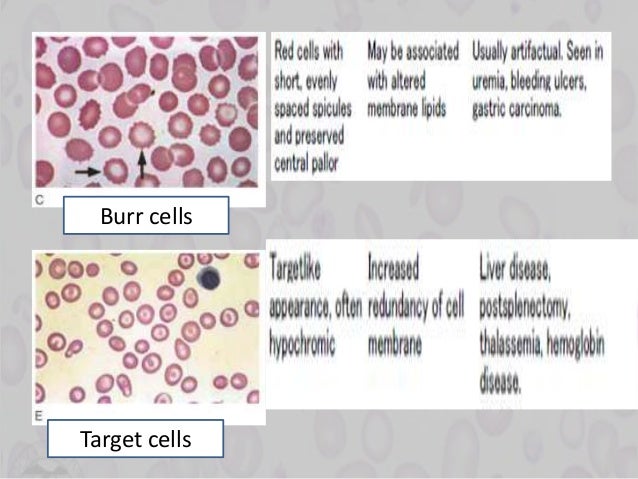 a child with anaemia - an approach