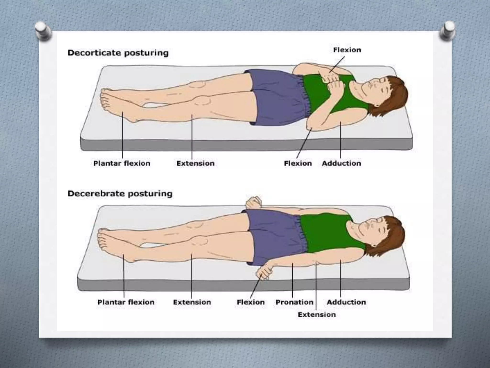 Approach to a child with coma | PPTX