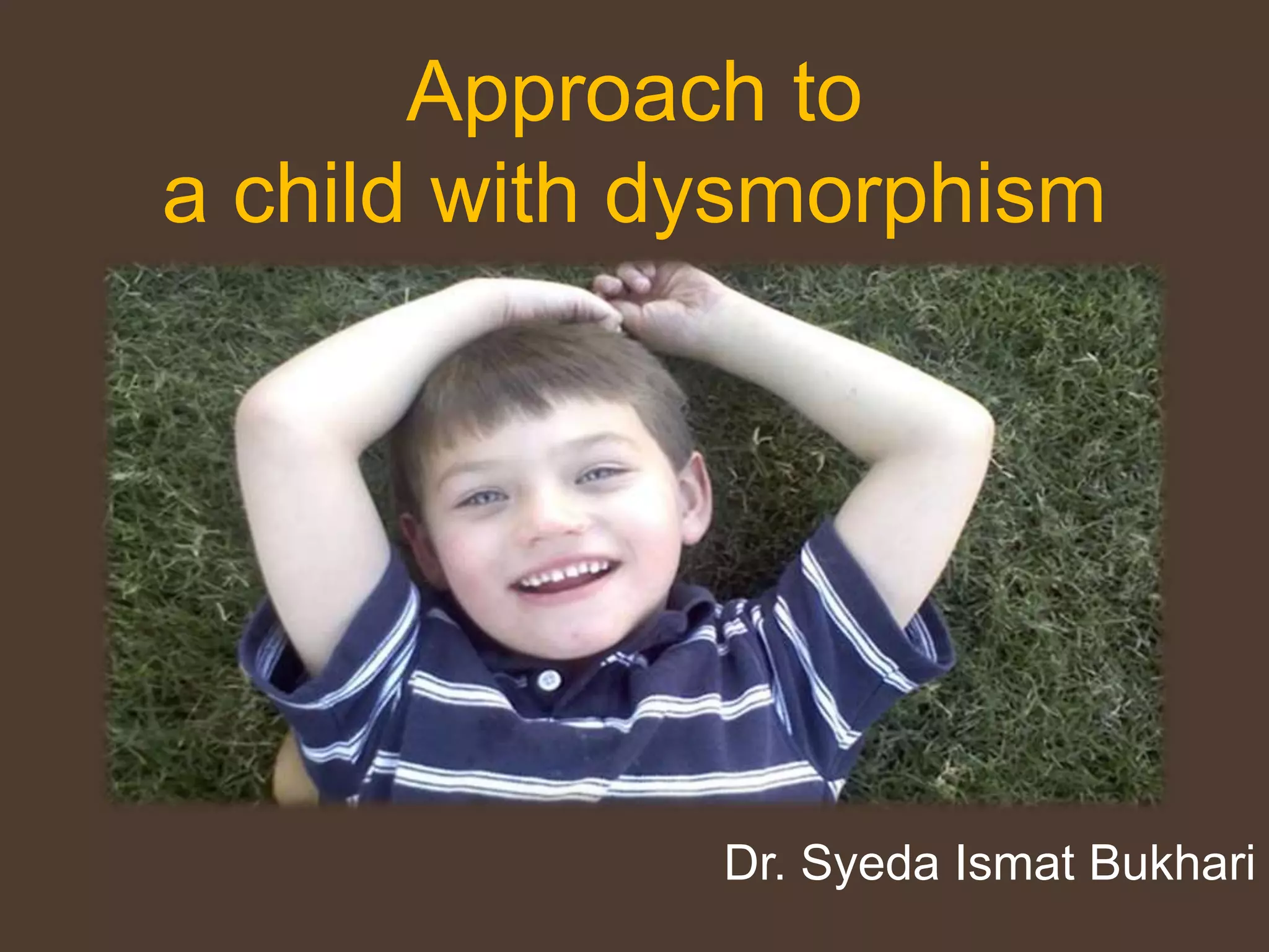 Approach to a child with dysmorphism | PPTX