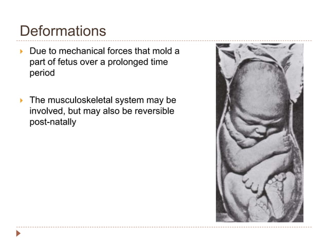 Approach to a child with dysmorphism | PPTX | Pregnancy | Reproductive ...