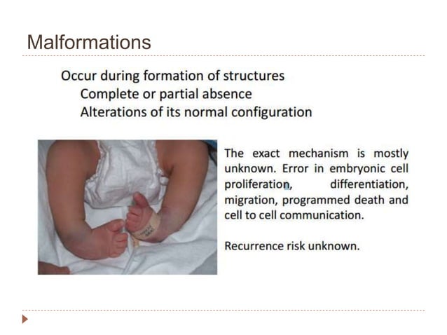 Approach to a child with dysmorphism | PPTX | Pregnancy | Reproductive ...