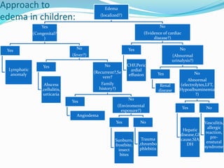 Approach to a child with edema | PPTX