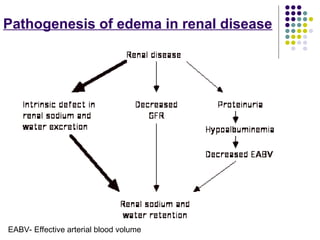 Approach to a child with Edema1111111.ppt