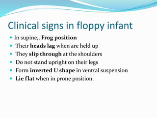 Approach to a child with hypotonia | PPTX