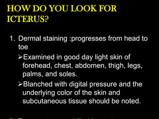 Approach to a child with jaundice | PPTX