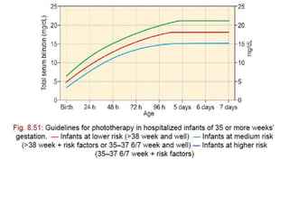 Approach to a child with jaundice | PPTX
