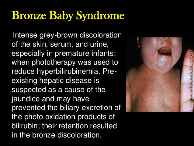 Approach to a child with jaundice