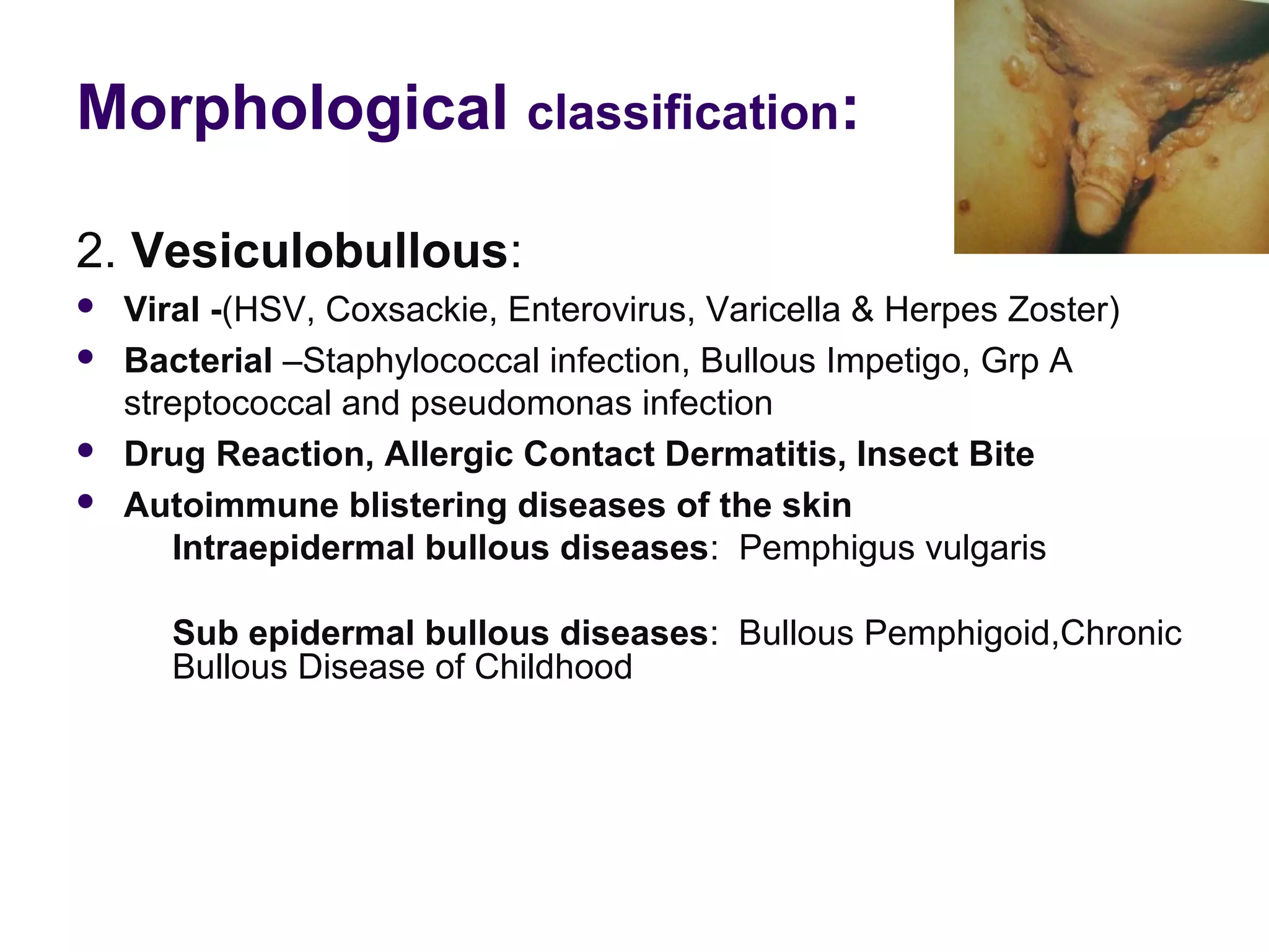 Approach to a_child_with_rash[1] | PPT