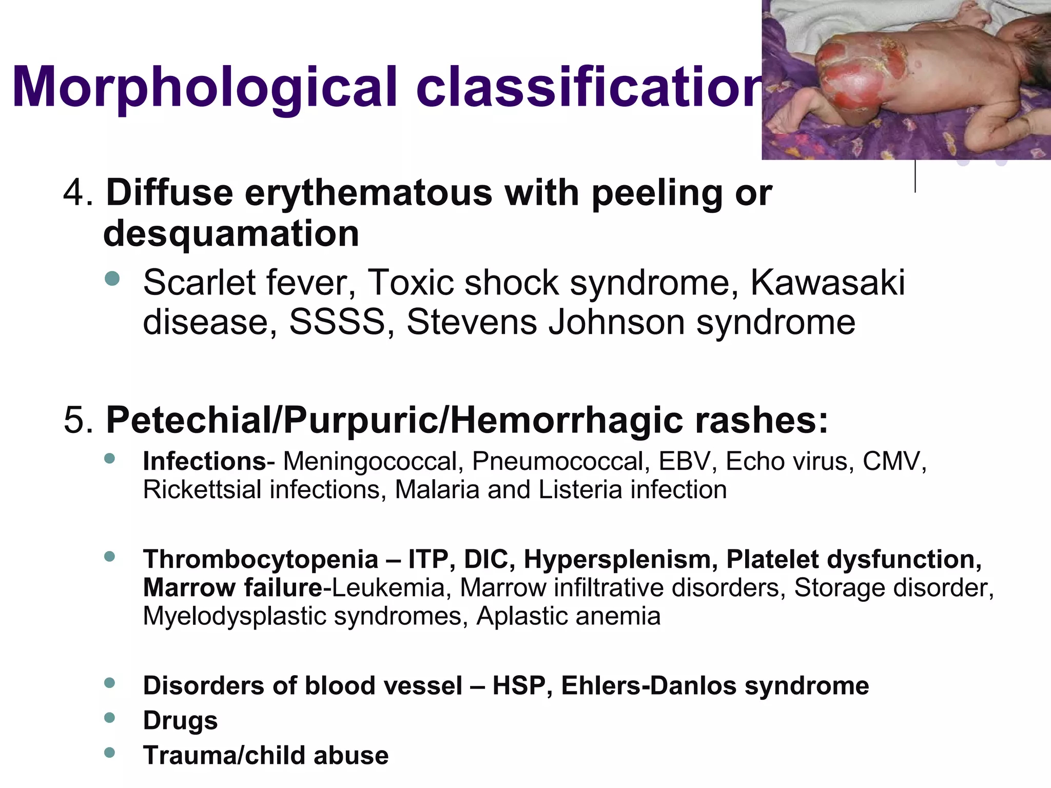 Approach to a_child_with_rash[1] | PPT