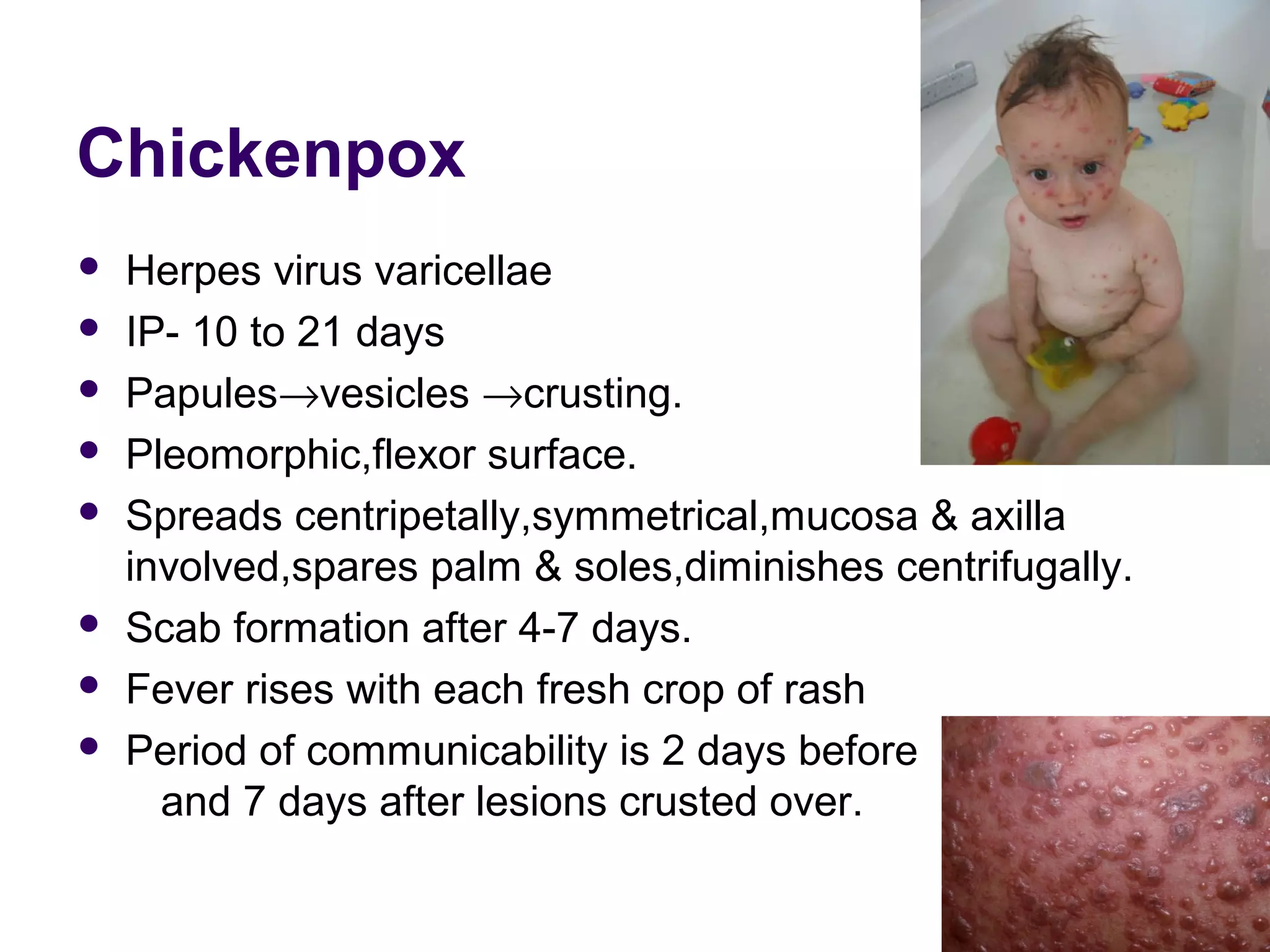 Approach to a_child_with_rash[1] | PPT