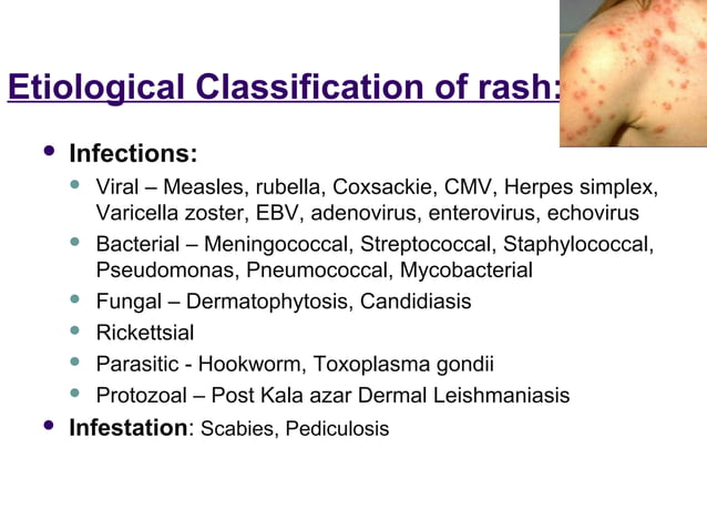 Approach to a_child_with_rash[1] | PPT | Skin and Dermatology ...