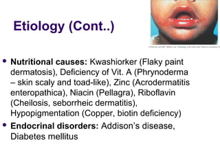 Approach to a_child_with_rash[1] | PPT