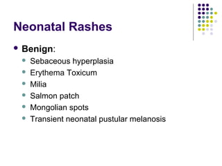 Approach to a_child_with_rash[1] | PPT