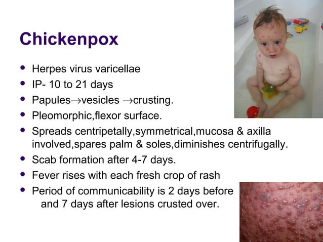 Approach to a_child_with_rash[1] | PPT | Skin and Dermatology ...