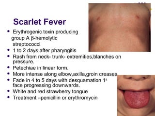 Approach to a_child_with_rash[1] | PPT