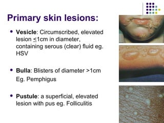 Approach to a_child_with_rash[1] | PPT