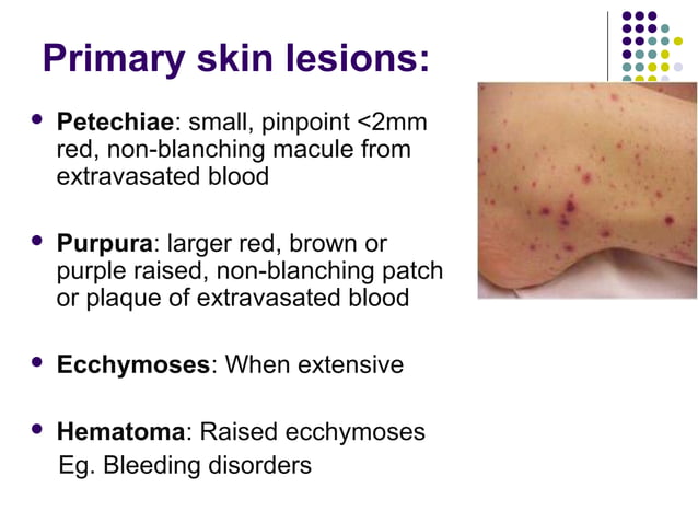 Approach to a_child_with_rash[1] | PPT | Skin and Dermatology ...