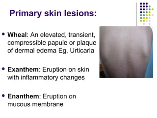 Approach to a_child_with_rash[1] | PPT