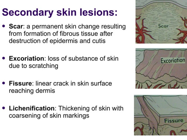 Approach to a_child_with_rash[1] | PPT | Skin and Dermatology ...